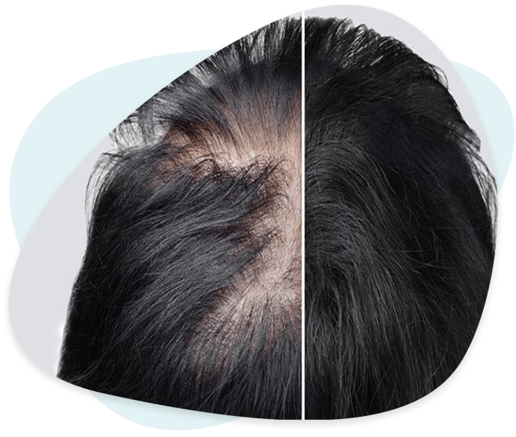 Before & Afters - Hair & Skin Science